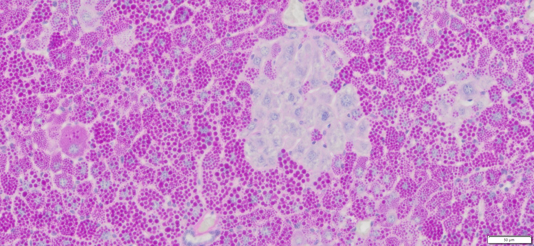 VitroView™ PAS-Diastase (PAS-D) Stain Kit