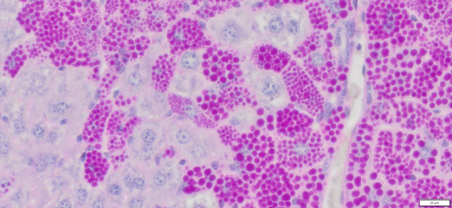 VitroView™ PAS-Diastase (PAS-D) Stain Kit